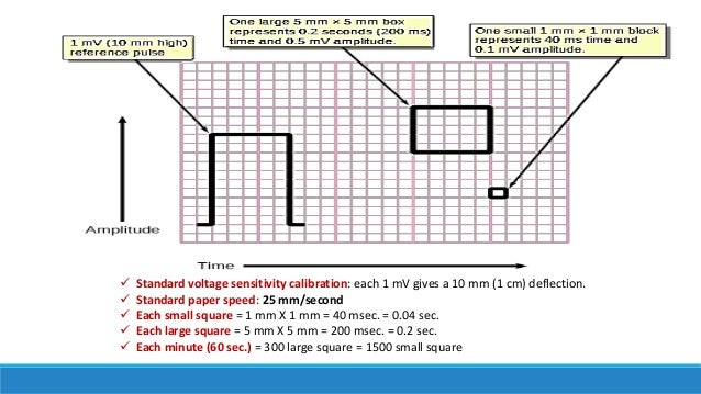 Basic ECG notes