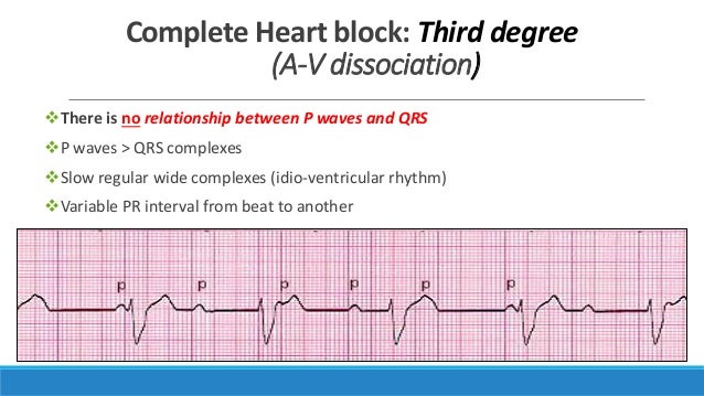 Basic ECG notes