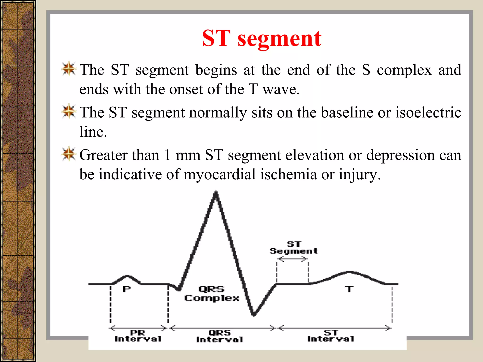 Ecg for Nurses... | PPT
