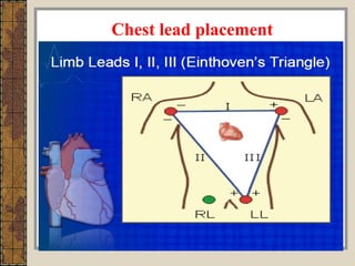 Ecg for Nurses... | PPT