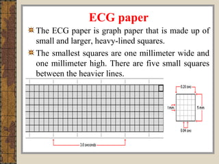 Ecg for Nurses... | PPT
