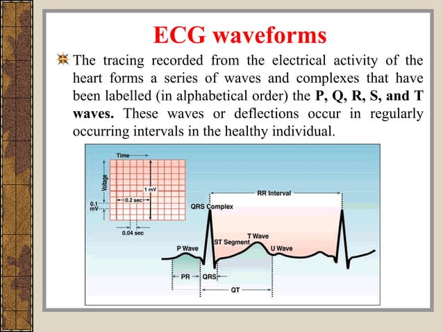 Ecg for Nurses... | PPT