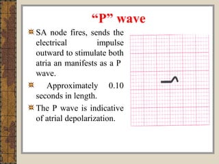 Ecg for Nurses... | PPT