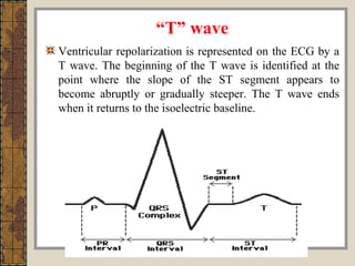 Ecg for Nurses... | PPT