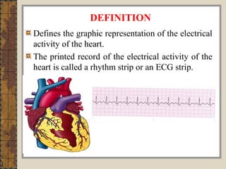 Ecg for Nurses... | PPT