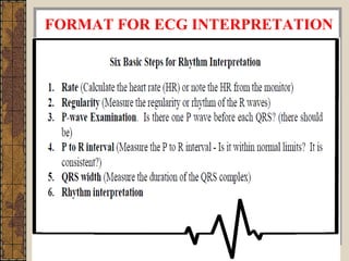 Ecg for Nurses... | PPT