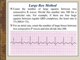 Ecg for Nurses... | PPT
