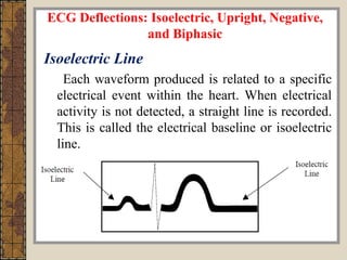 Ecg for Nurses... | PPT