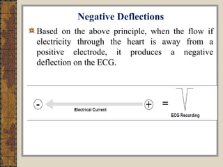 Ecg for Nurses... | PPT