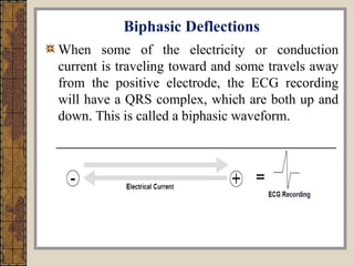 Ecg for Nurses... | PPT