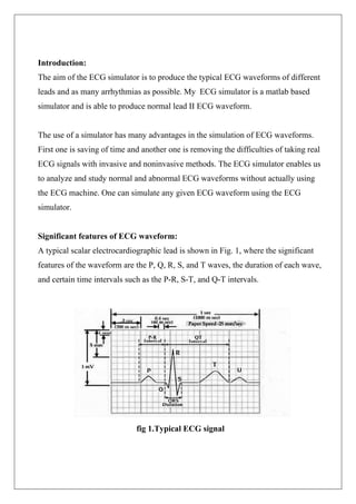 Ecg | PDF