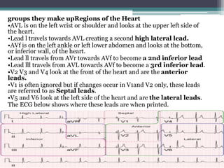 ECG | PPTX