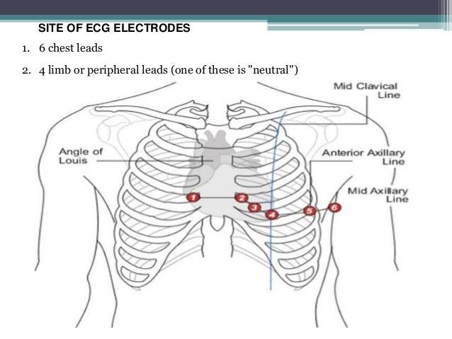 ECG