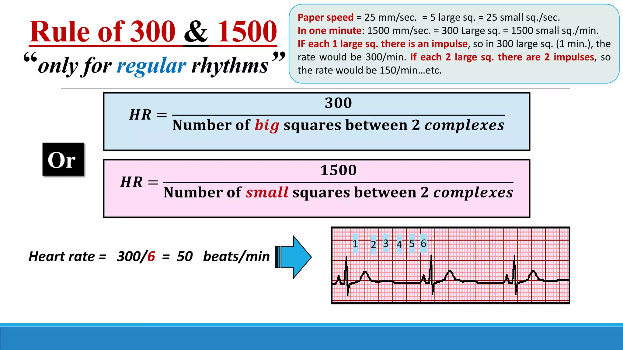 ECG, step by step approach (Updated) | PPTX