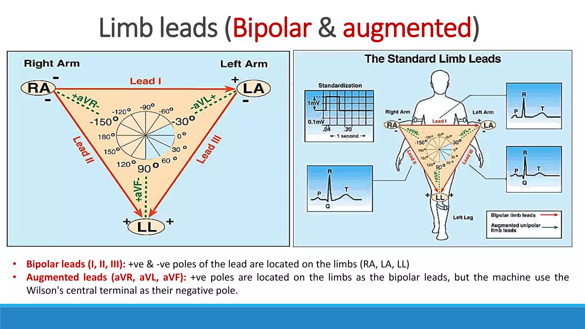 ECG, step by step approach (Updated) | PPTX