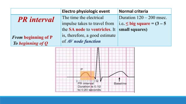 ECG, step by step approach (Updated) | PPTX
