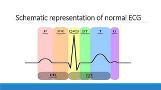 ECG, step by step approach (Updated) | PPTX