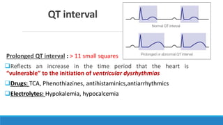 ECG, step by step approach (Updated) | PPTX