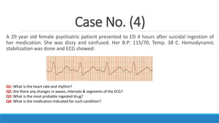 ECG, step by step approach (Updated) | PPTX