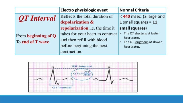 ECG, step by step approach (Updated)