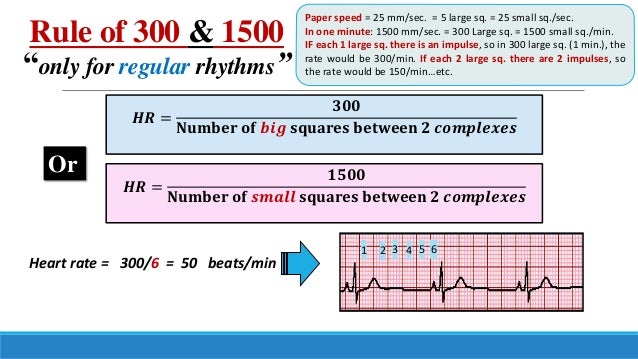 ECG, step by step approach (Updated) ECG, step by step approach (Updated)