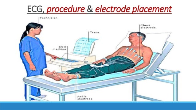 Ecg Step By Step Approach Updated - vrogue.co Ecg Step By Step Approach Updated - vrogue.co