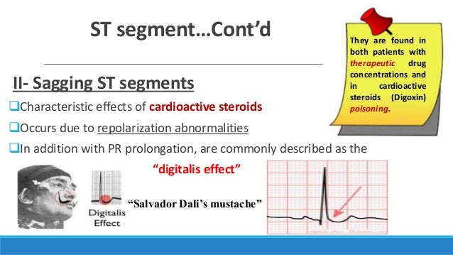 ECG, step by step approach (Updated) ECG, step by step approach (Updated)