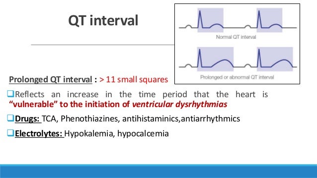 ECG, step by step approach (Updated) ECG, step by step approach (Updated)