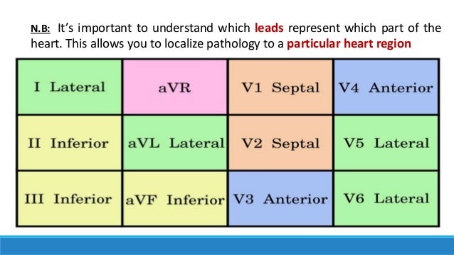 ECG, step by step approach (Updated)