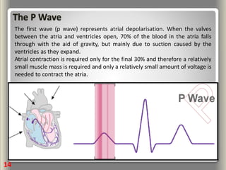 ECG | PDF