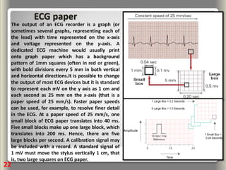 ECG | PDF