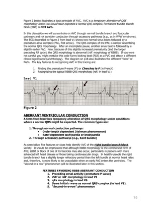 Ecg | PDF | Heart and Cardiovascular Diseases | Diseases and Conditions