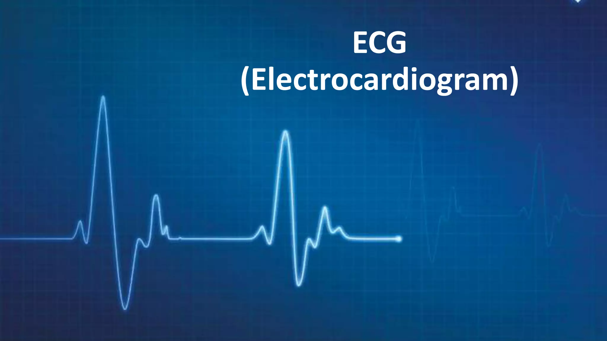 ECG (Electrocardiogram) | PPTX