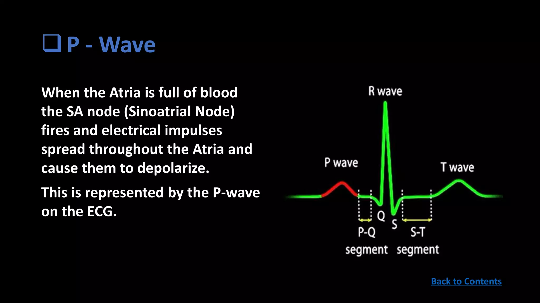 ECG (Electrocardiogram) | PPTX