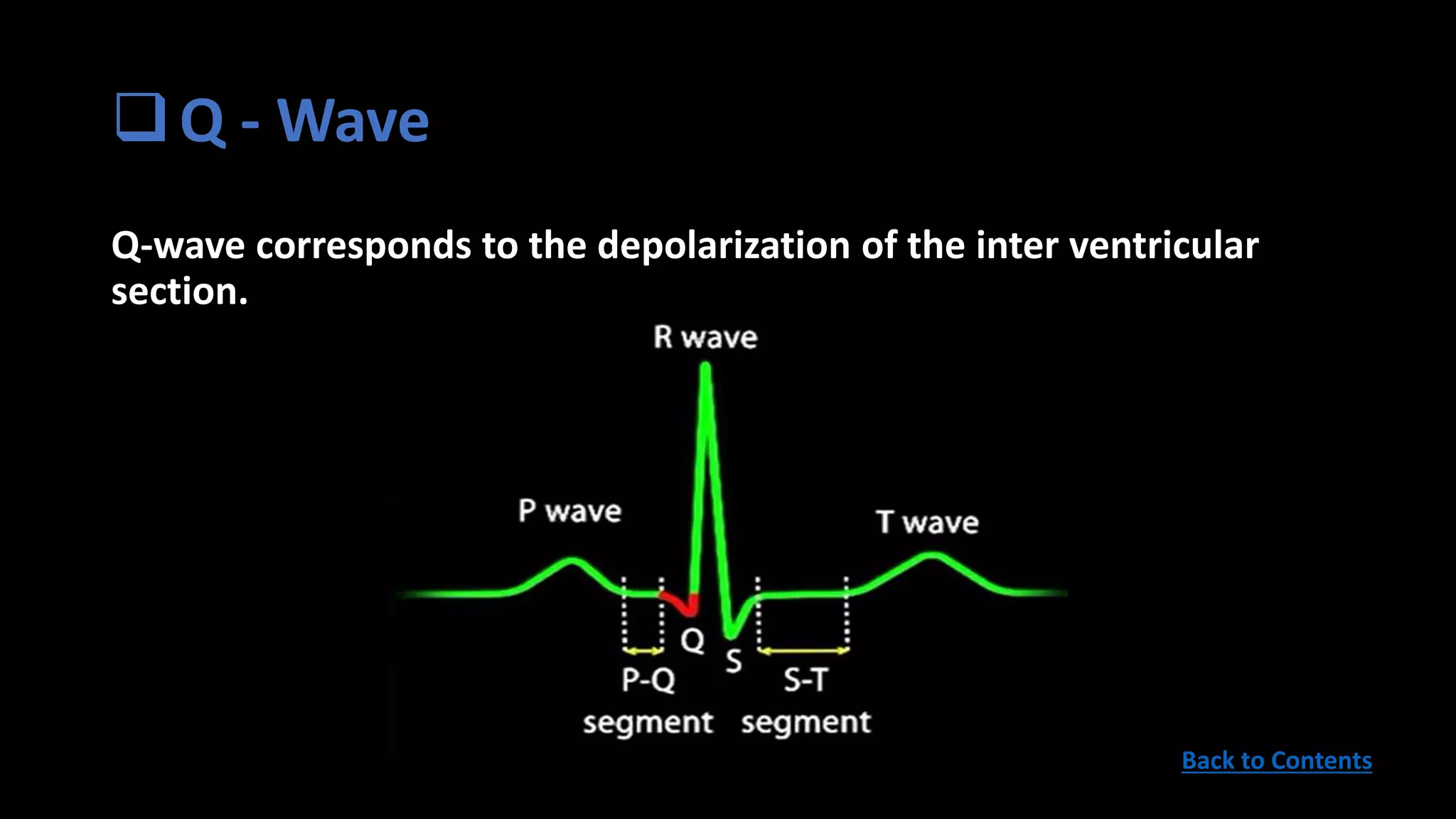 ECG (Electrocardiogram) | PPTX