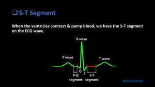 ECG (Electrocardiogram) | PPTX