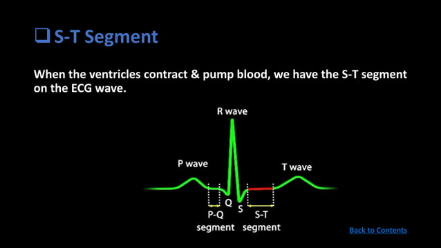 ECG (Electrocardiogram) | PPT