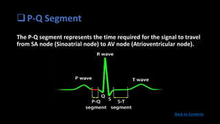ECG (Electrocardiogram) | PPTX