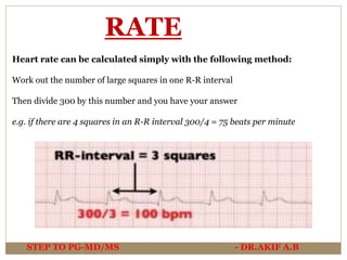 ECG Interpretation Cheat Sheet WHAT EXACTLY IS AN ECG? An, 56% OFF