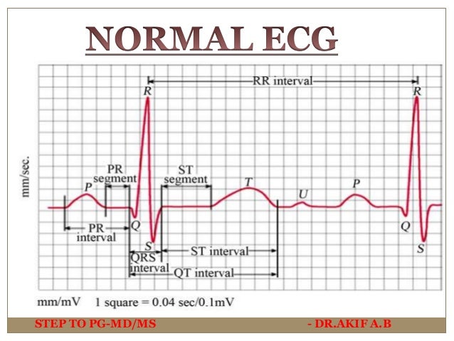 Ecg