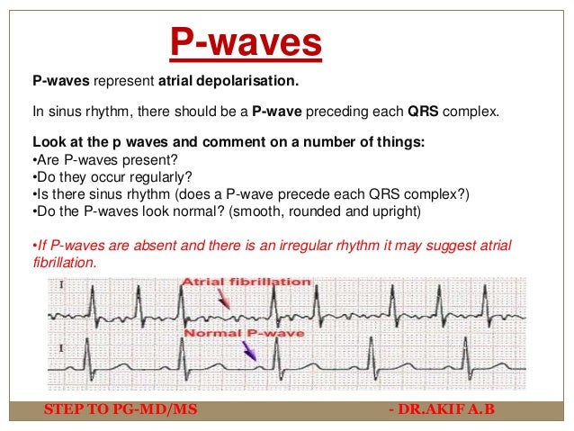 Ecg