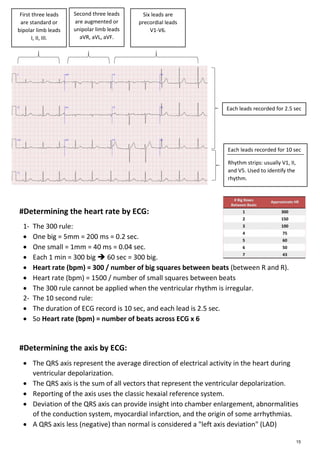 Ecg | PDF