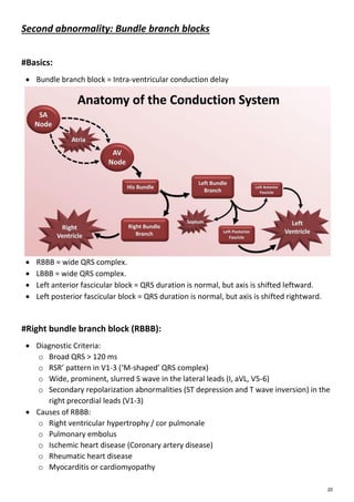 Ecg | PDF
