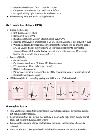 Ecg | PDF