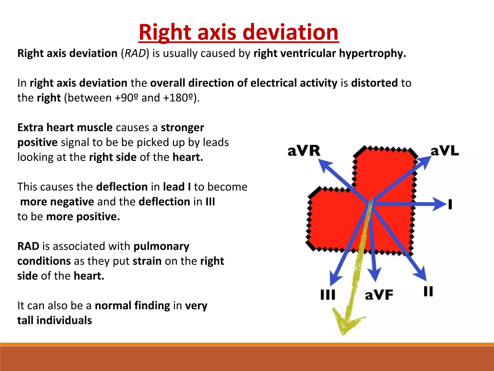 Ecg | PPT