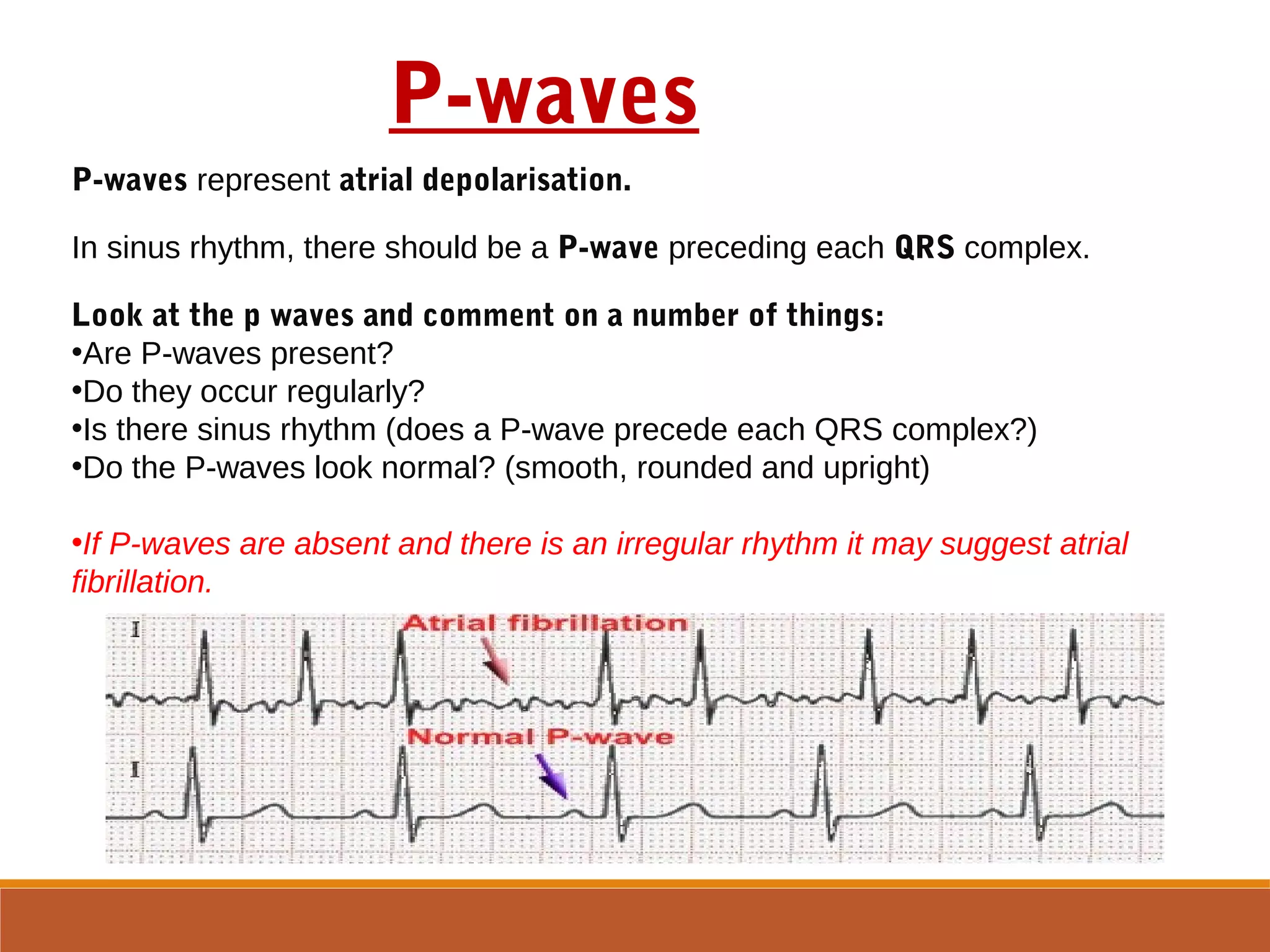 Ecg | PPT