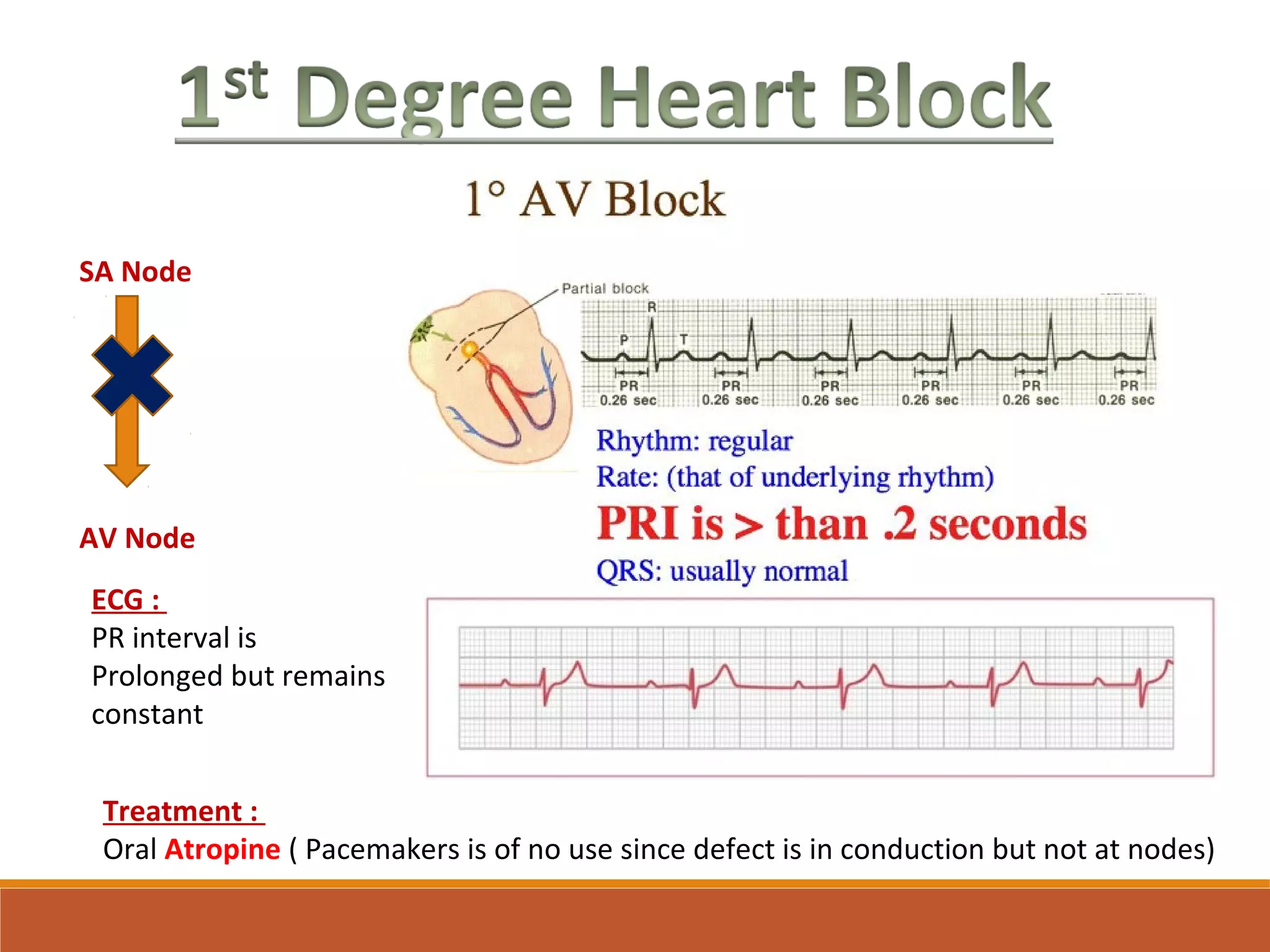 Ecg | PPT