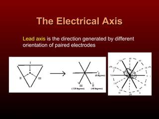 Understanding and Management Of ECG’s | PPT