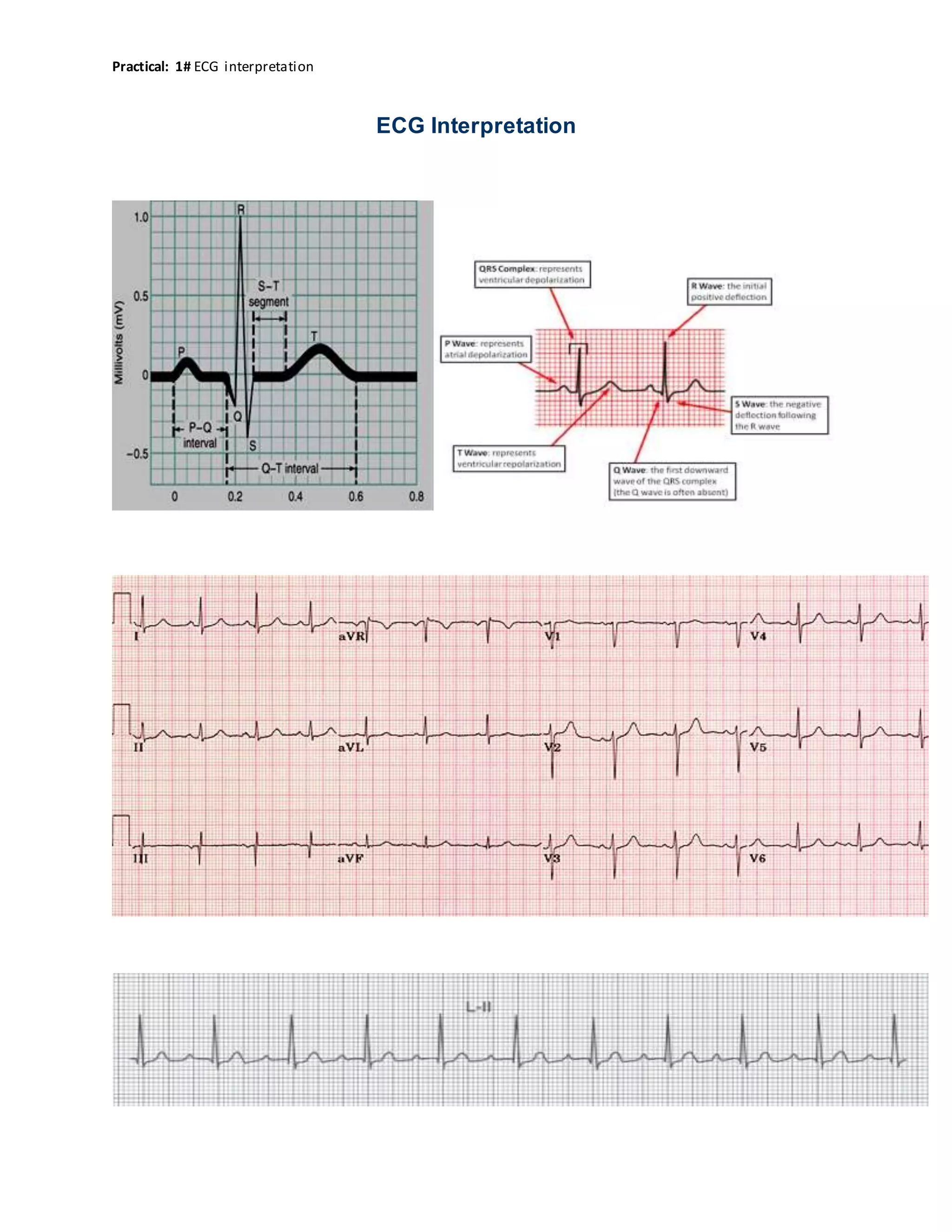 Ecg | DOCX
