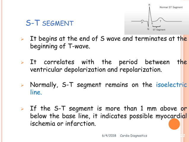 ECG (easy explanation) | PPTX | Heart and Cardiovascular Diseases ...